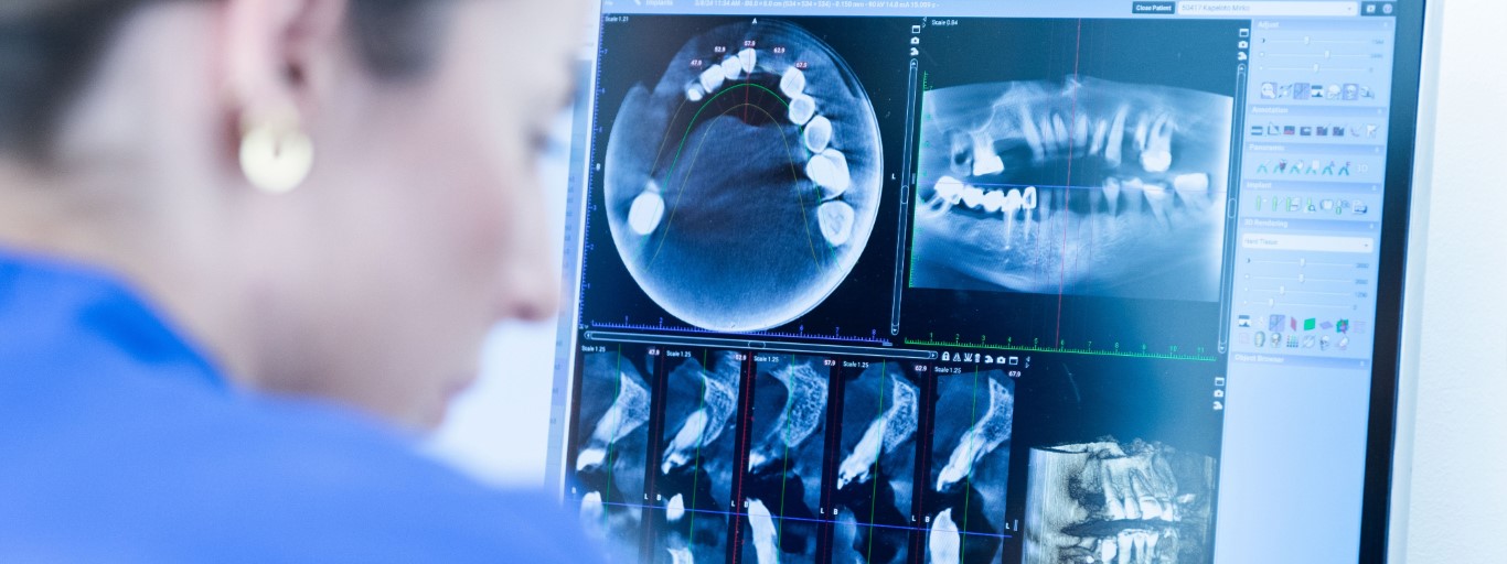 Dijagnostika i rendgen čeljusti – Precizna slika | Orto Nova