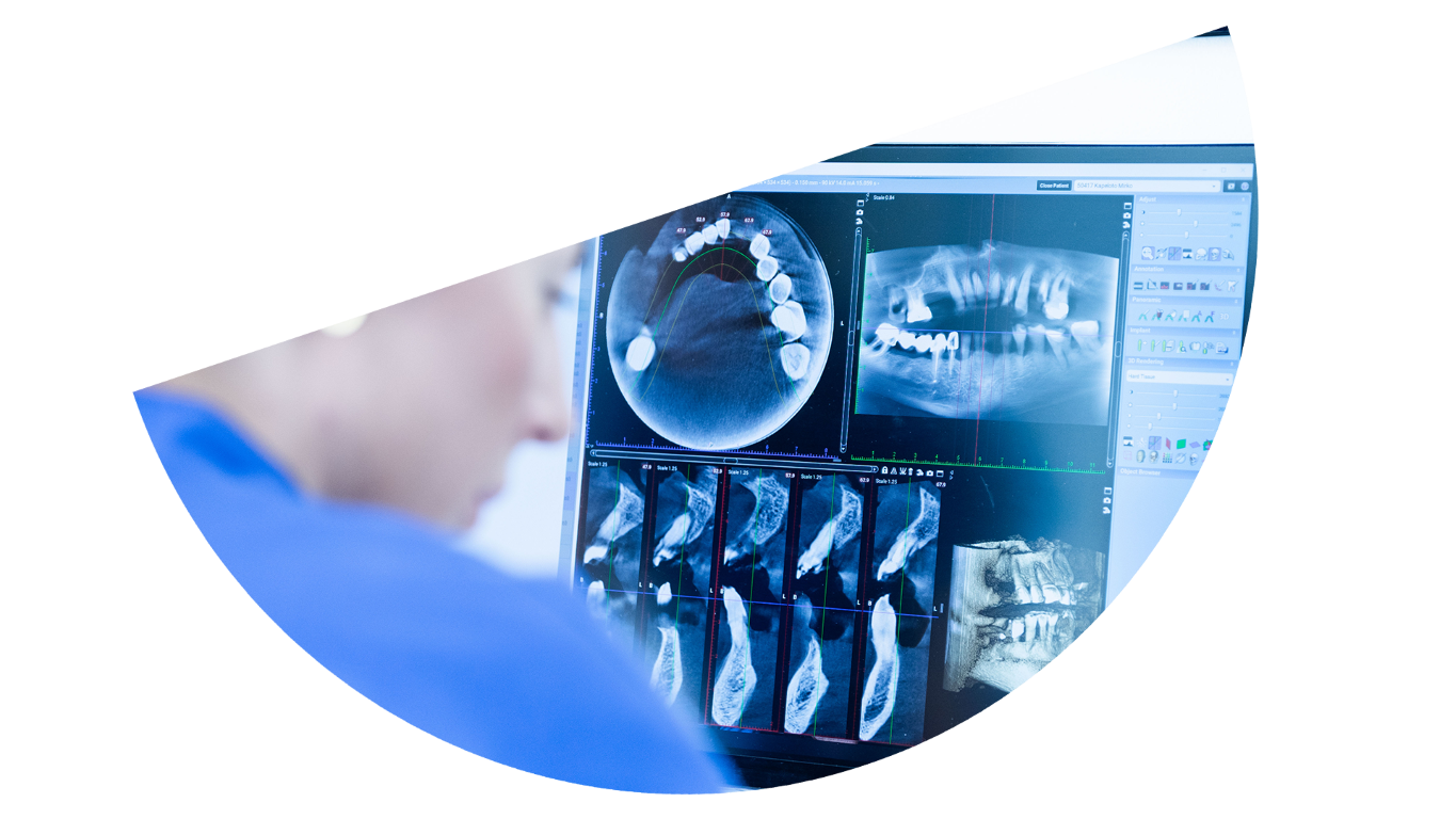 Dijagnostika i rendgen čeljusti – Precizna slika | Orto Nova
