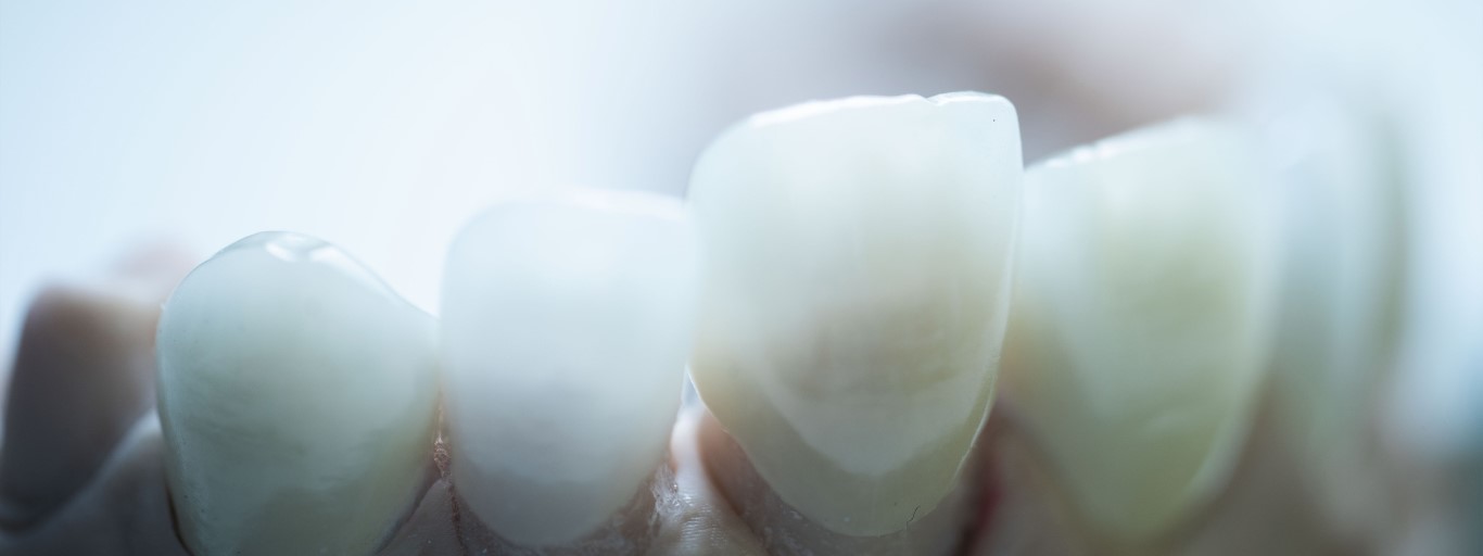 Mobilna protetika – Novi osmijeh bez velikih troškova | Orto Nova